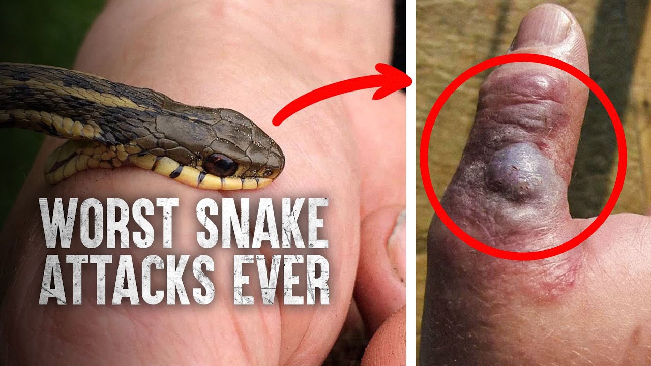 Animal Experts Break Down Viral Snake Attacks and What You Can Learn