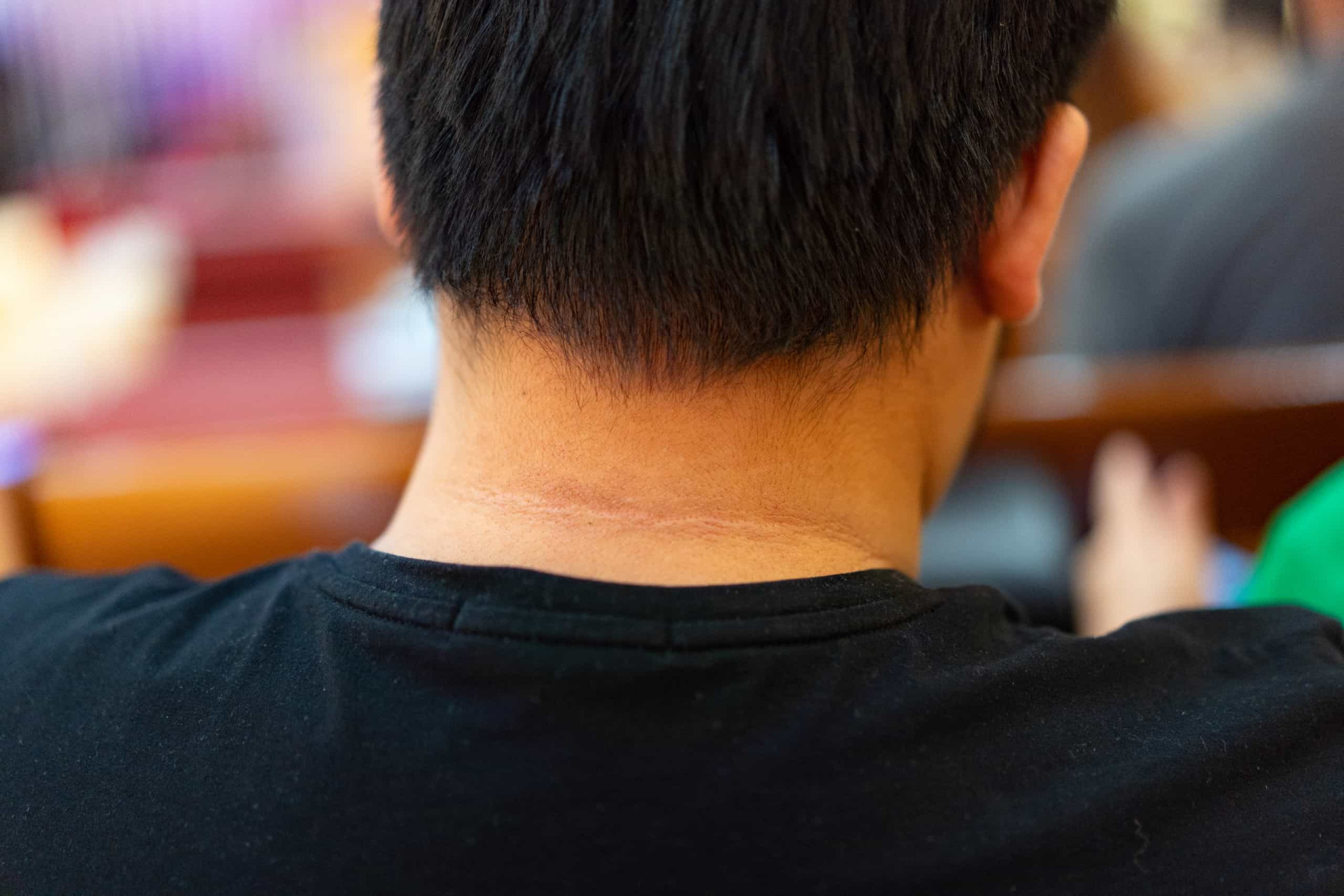 Unexpected symptoms that could indicate diabetes