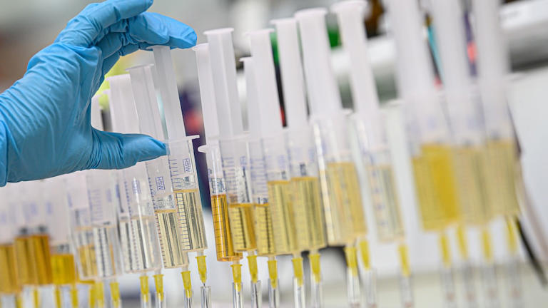 Achtung Warnsignal: Diese Urinfarbe kann auf ein Problem hinweisen