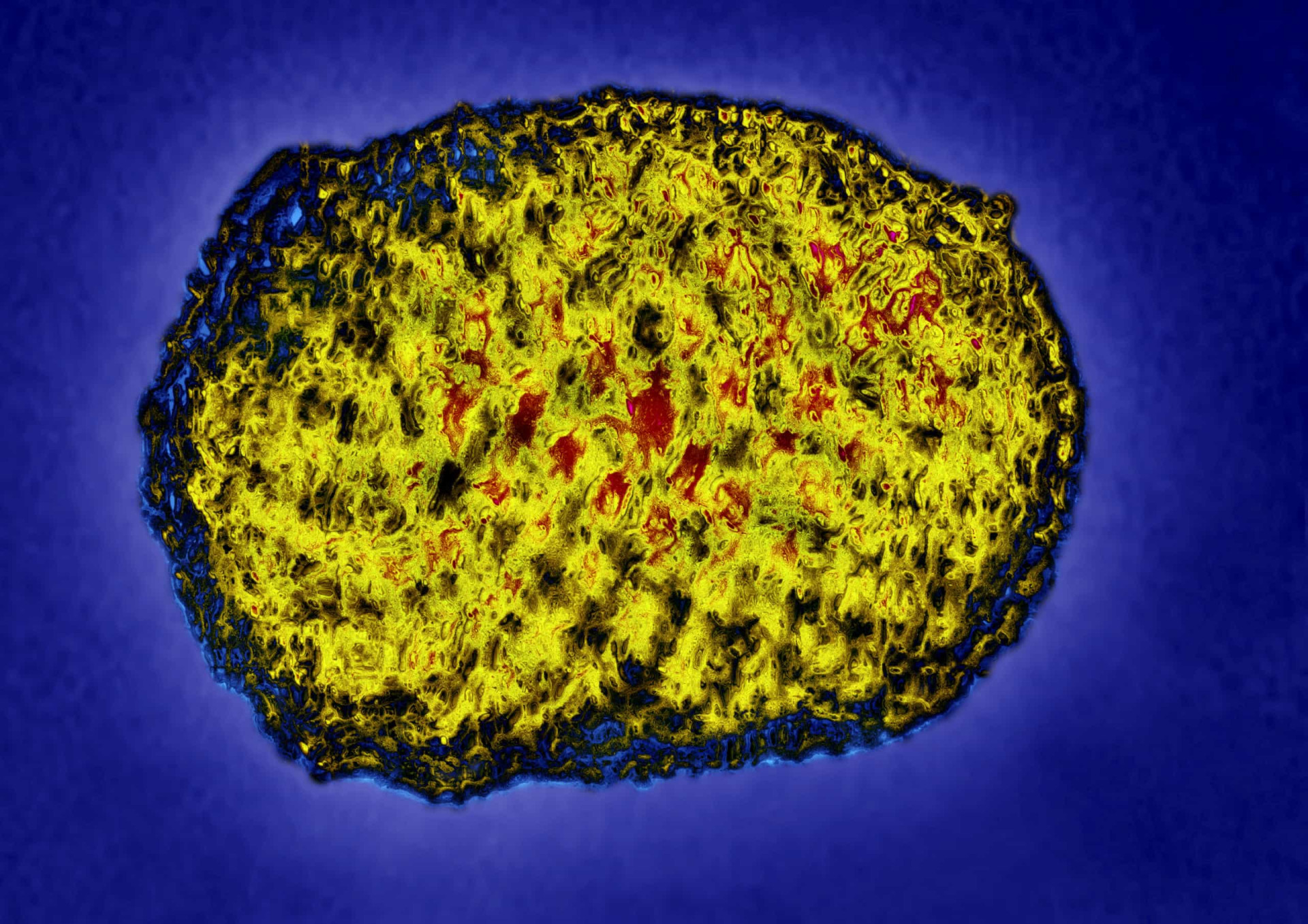 Viruses and bacteria: the deadly yet fascinating microorganisms