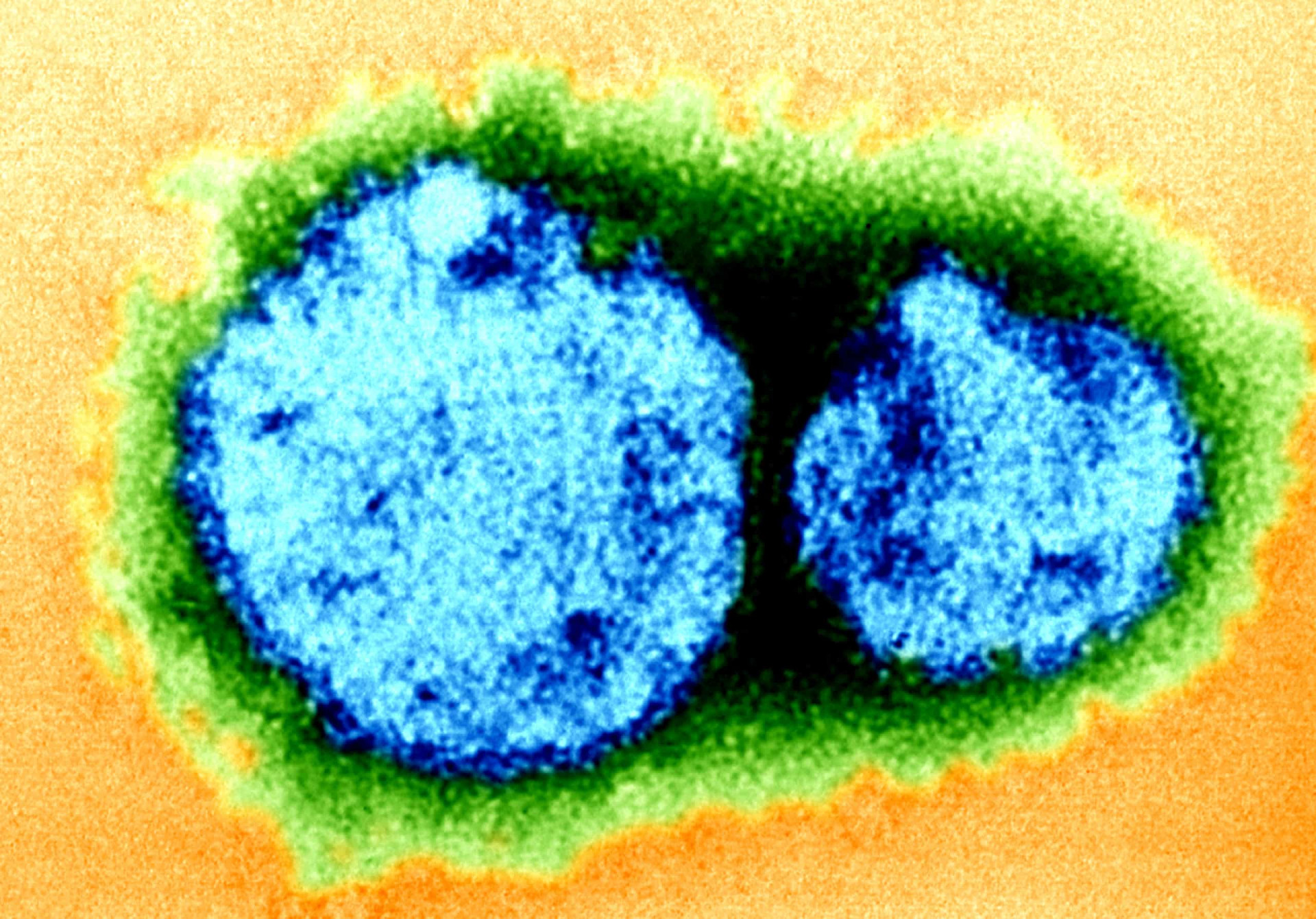 Viruses and bacteria: the deadly yet fascinating microorganisms
