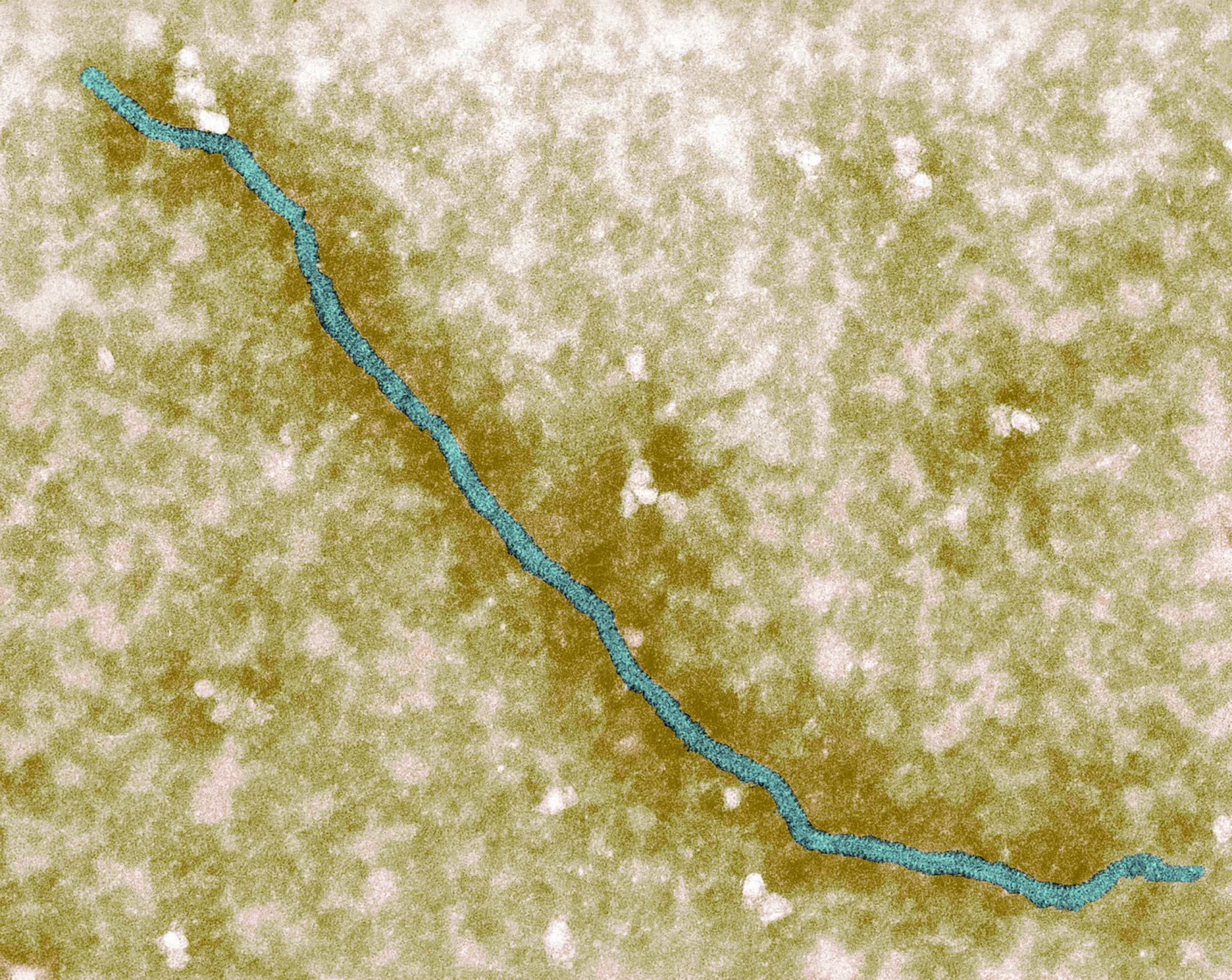 Viruses and bacteria: the deadly yet fascinating microorganisms