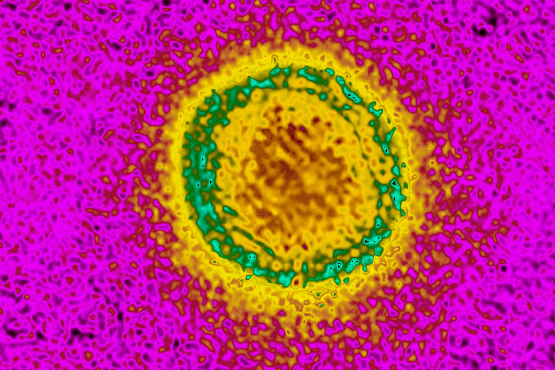 Viruses and bacteria: the deadly yet fascinating microorganisms