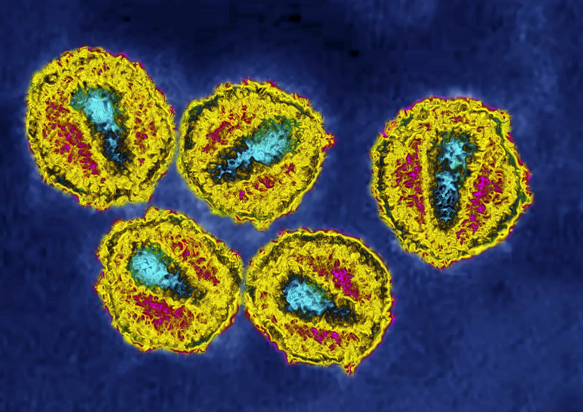 Viruses and bacteria: the deadly yet fascinating microorganisms