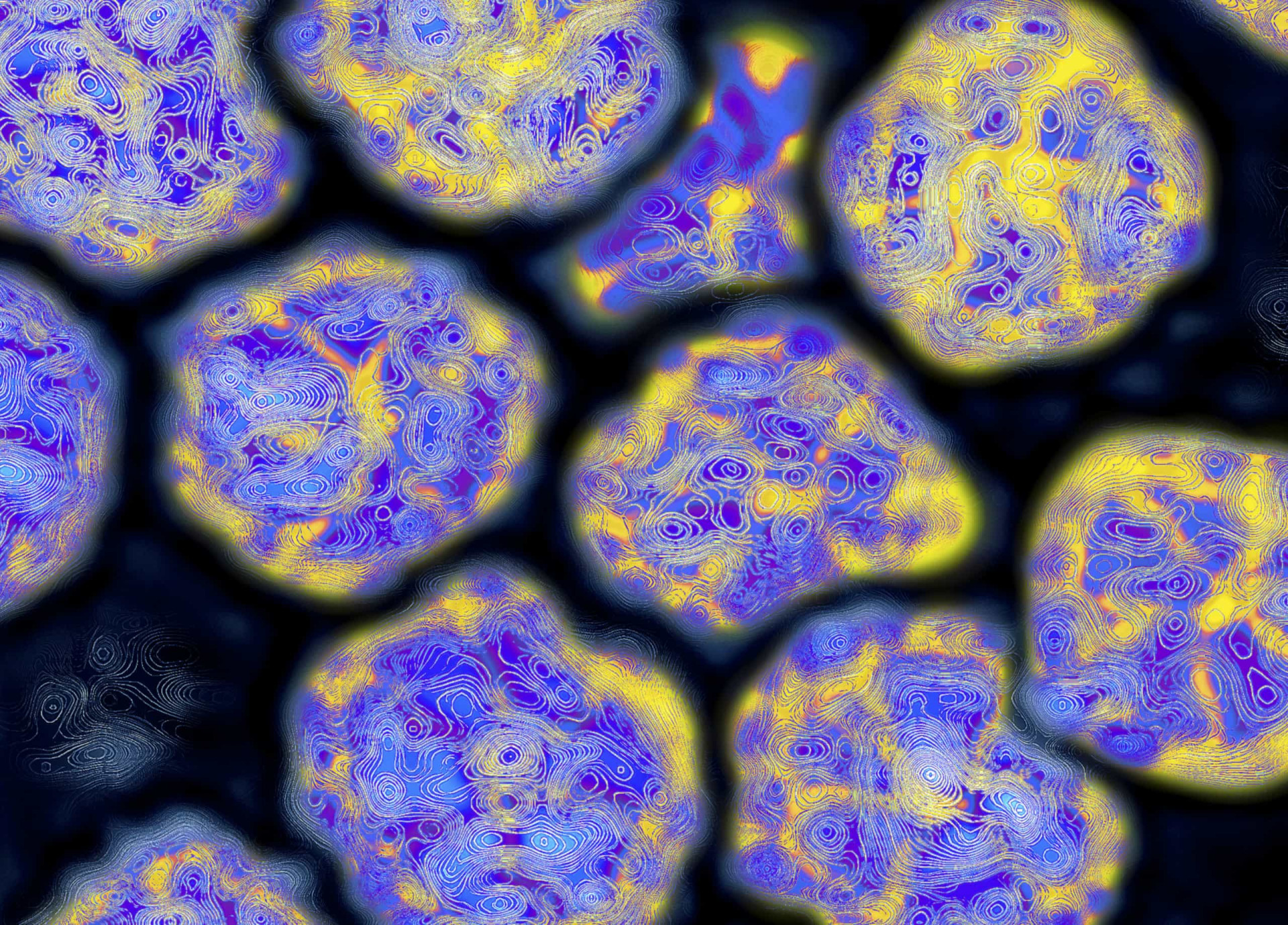 Viruses and bacteria: the deadly yet fascinating microorganisms