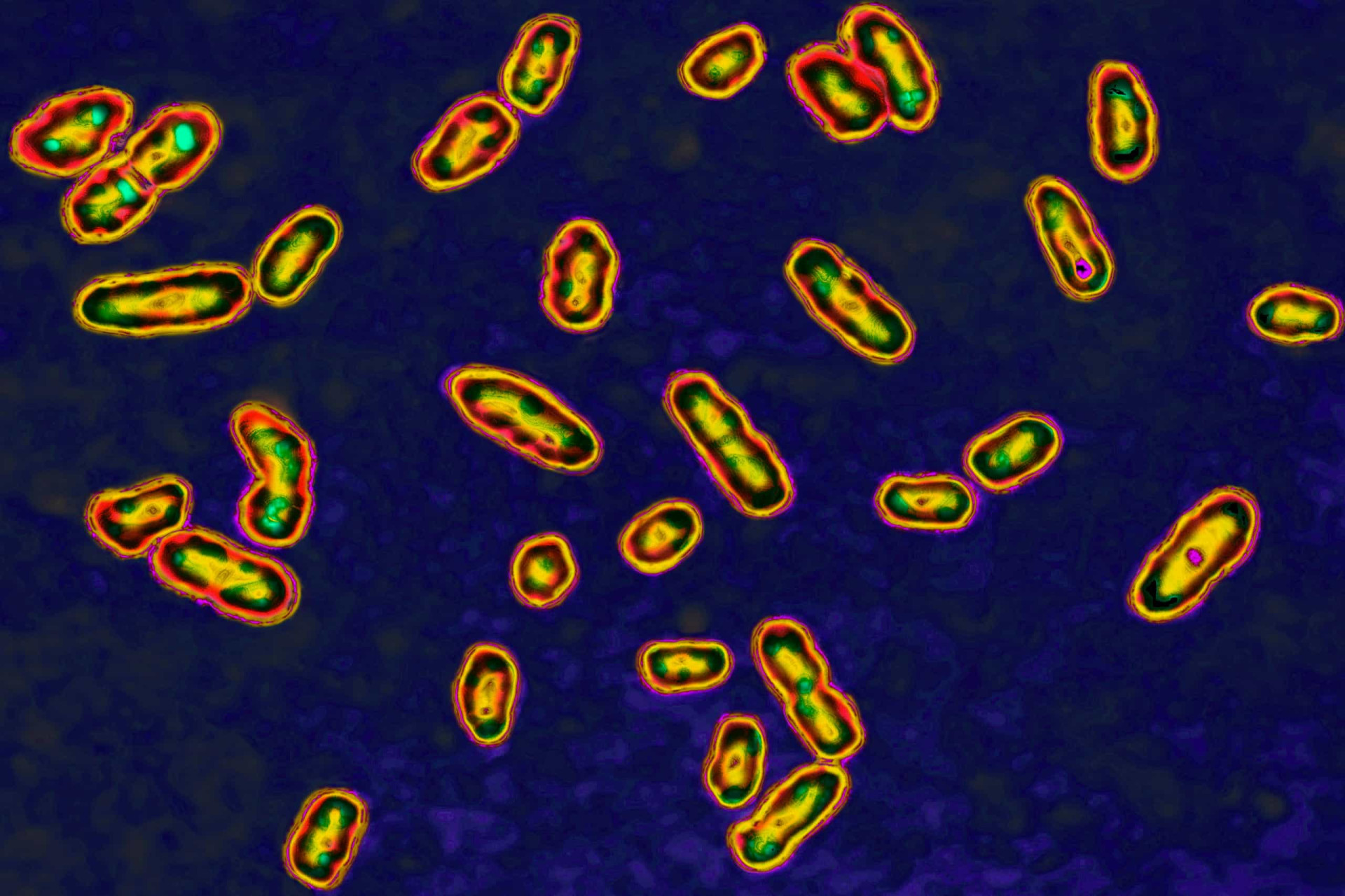 Viruses and bacteria: the deadly yet fascinating microorganisms