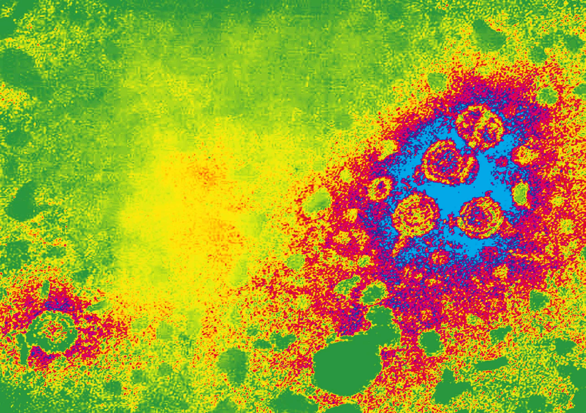 Viruses and bacteria: the deadly yet fascinating microorganisms