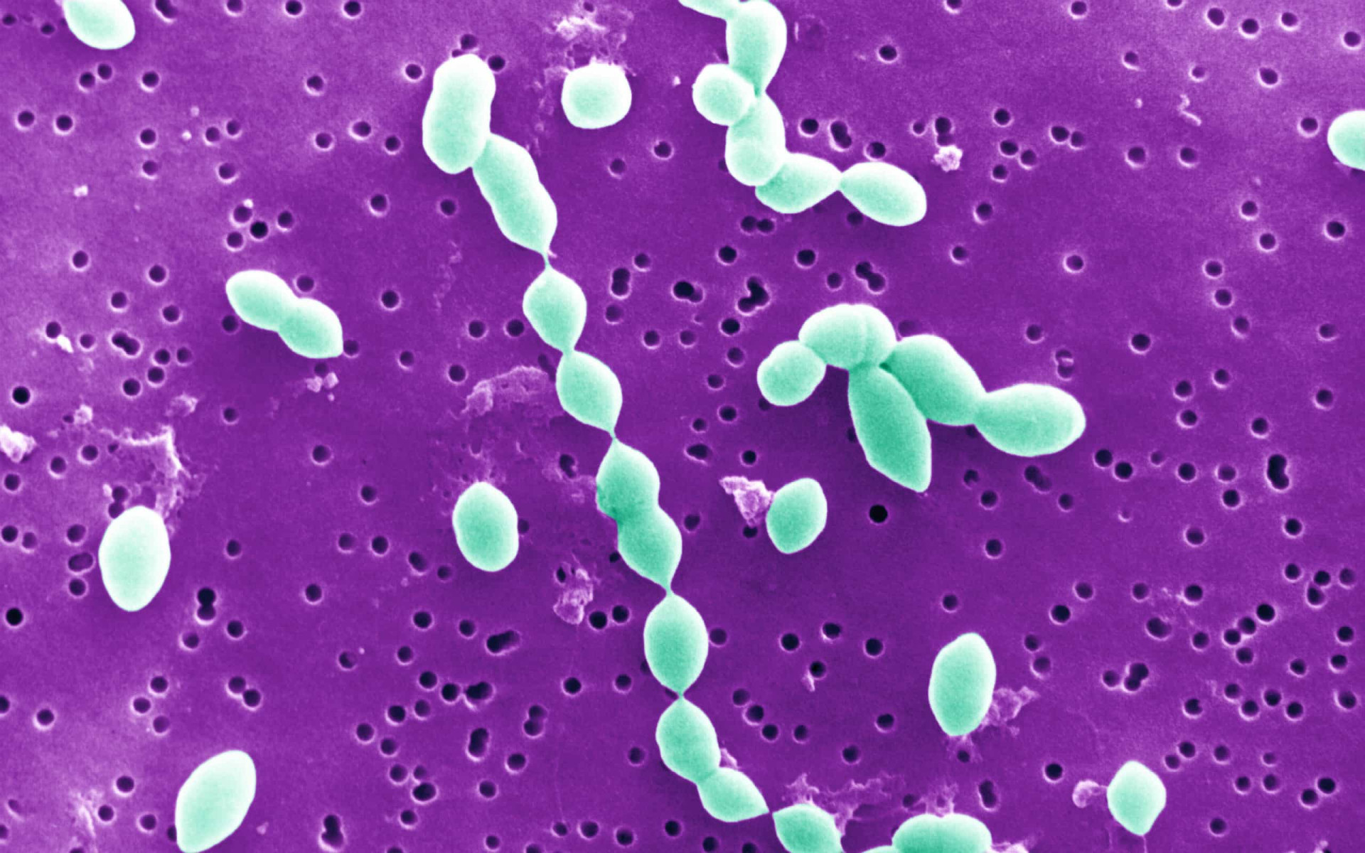 The lethal beauty of viruses and bacteria