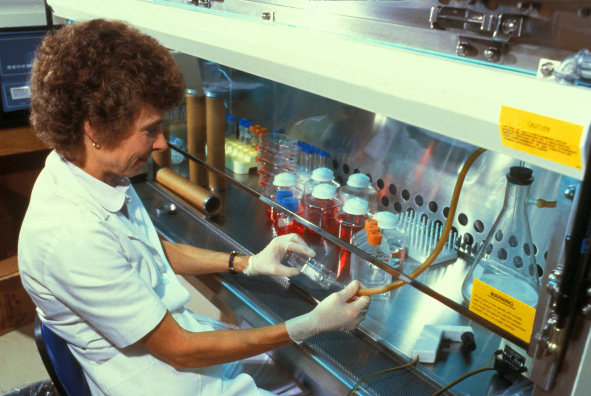 A short history of the AIDS crisis in the United States