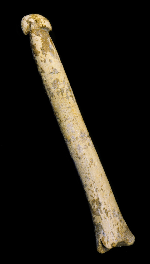 Proč lidé nemají baculum a co to vlastně je?