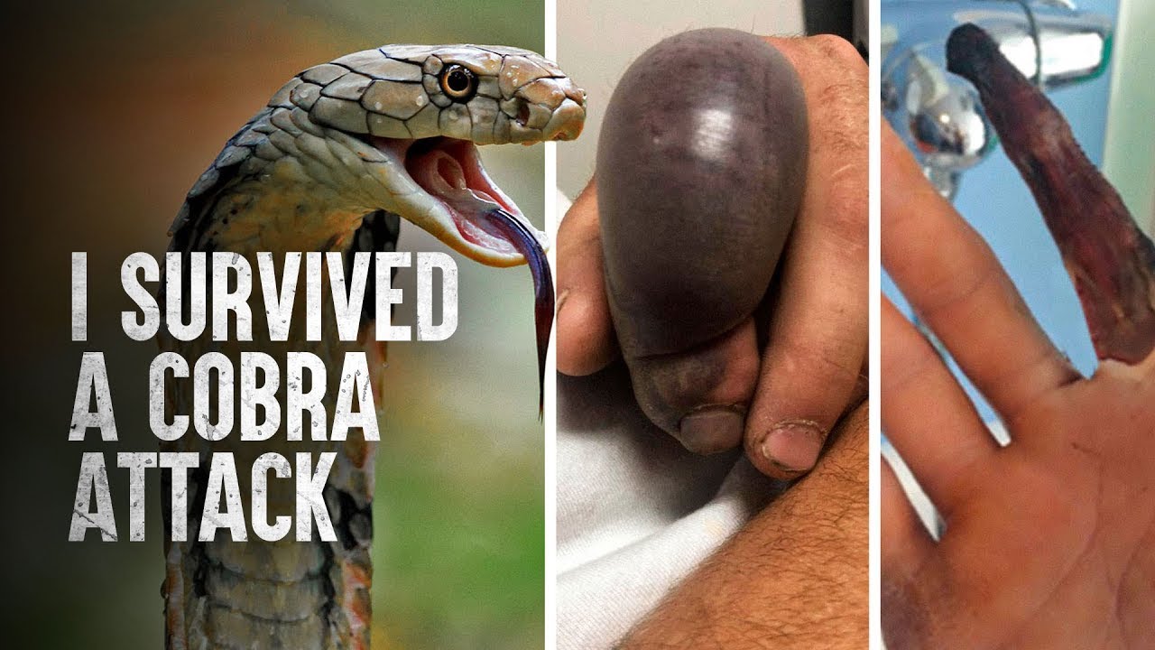 How to React During a King Cobra Attack: Life-Saving Tips