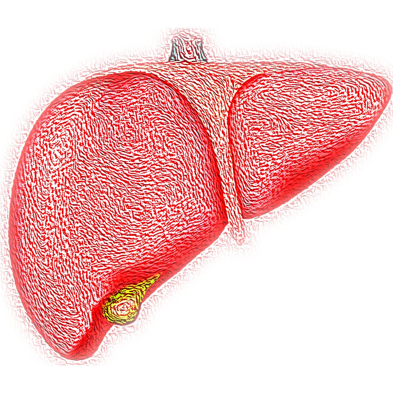 Gene therapy shows promise in ARC syndrome, a deadly childhood liver ...