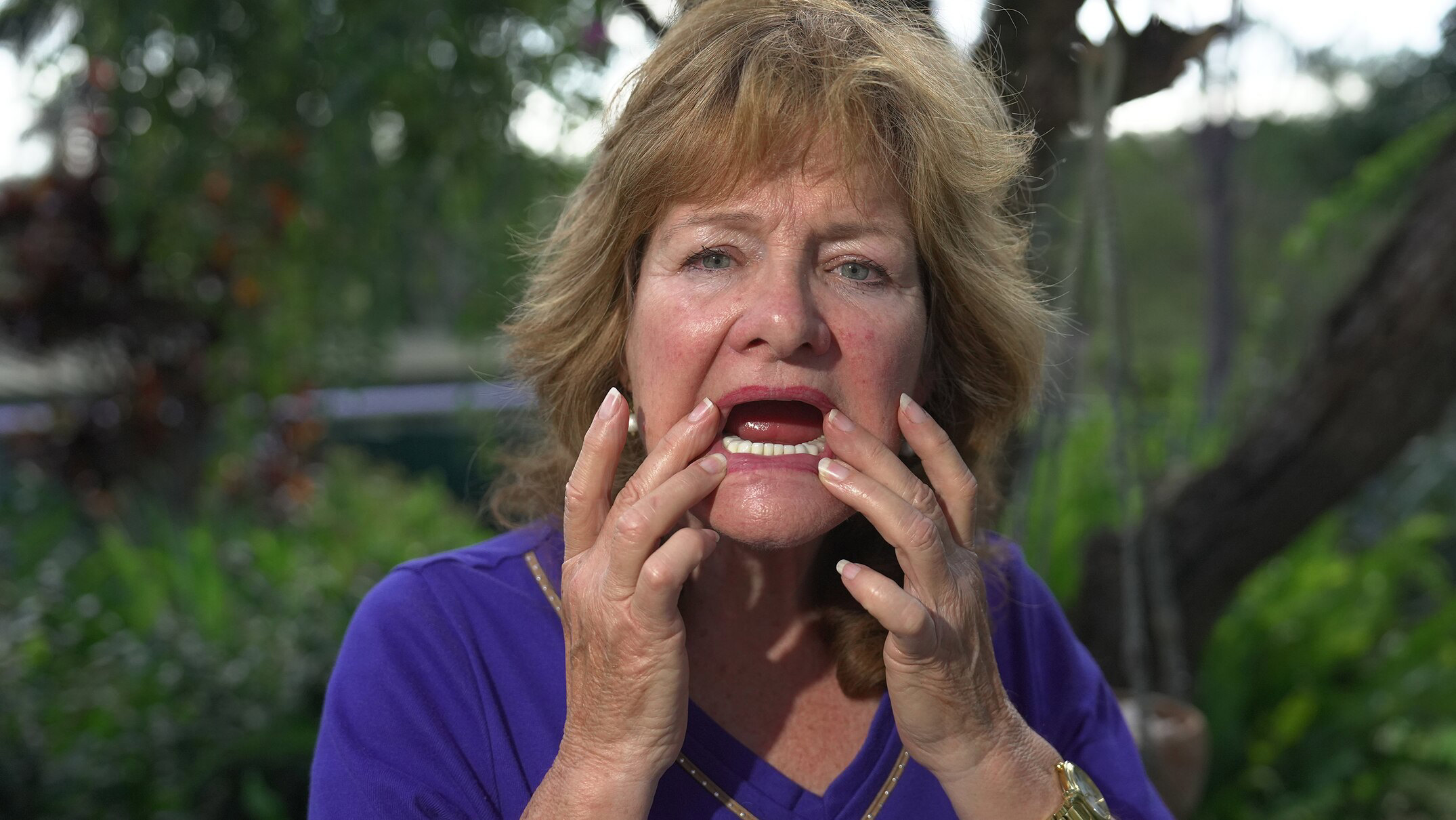 An Indian dental clinic spruiking lower-cost dentistry to Australians ... An Indian dental clinic spruiking lower-cost dentistry to Australians ...