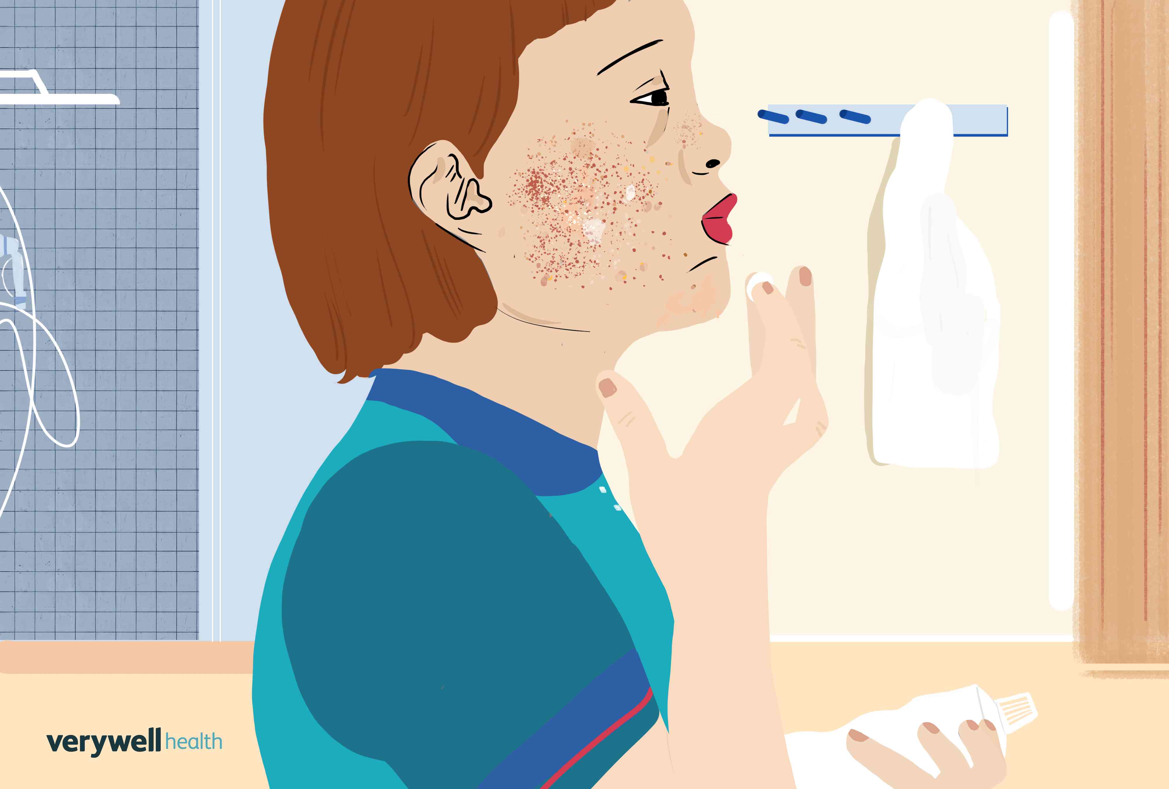 What Is that Itchy Rash With Blisters?