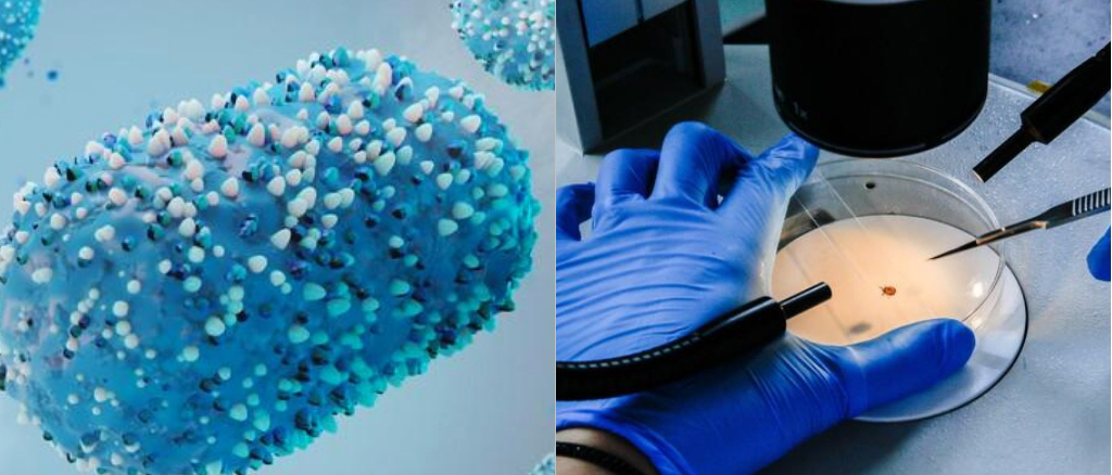 Il virus Mpox, come muta e si diffonde il vaiolo delle scimmie Il virus Mpox, come muta e si diffonde il vaiolo delle scimmie