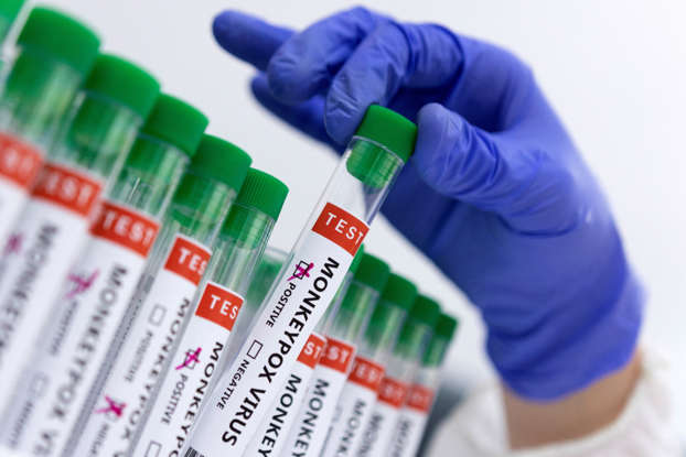 O que é a Mpox e o Brasil deve estar preocupado com a doença? O que é a Mpox e o Brasil deve estar preocupado com a doença?