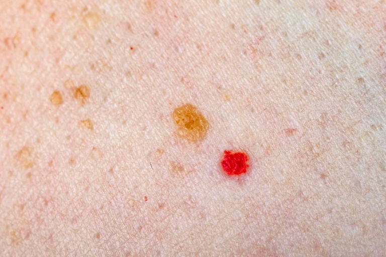 19 possible causes of concerning red spots