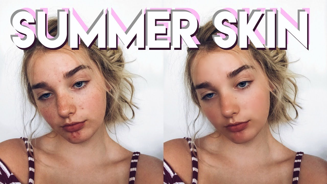 How Avrey Gets Clear Skin for the Summer