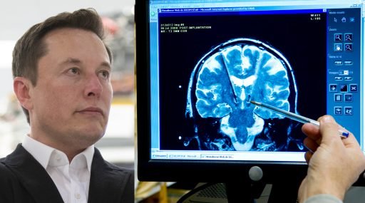 Neuralink reçoit l’approbation du Canada pour le premier essai humain ...