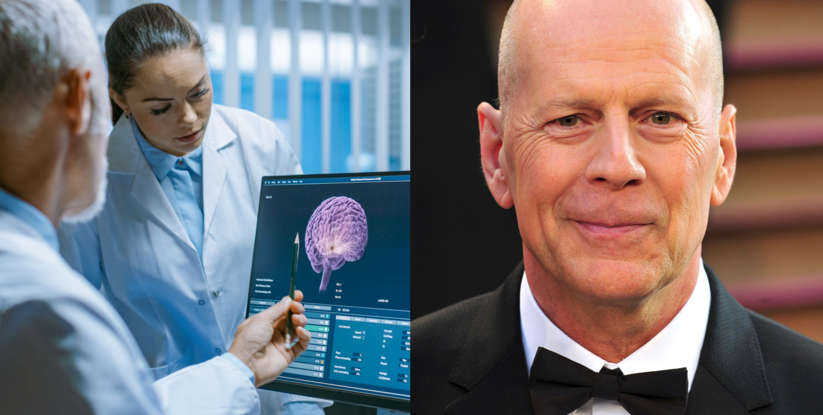 Demenza frontotemporale, la brutta malattia che ha colpito Bruce Willis Demenza frontotemporale, la brutta malattia che ha colpito Bruce Willis
