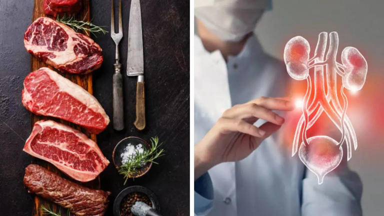 Experts Blame Diet For Increasing Urinary Tract Infections Among Youngsters Experts Blame Diet For Increasing Urinary Tract Infections Among Youngsters