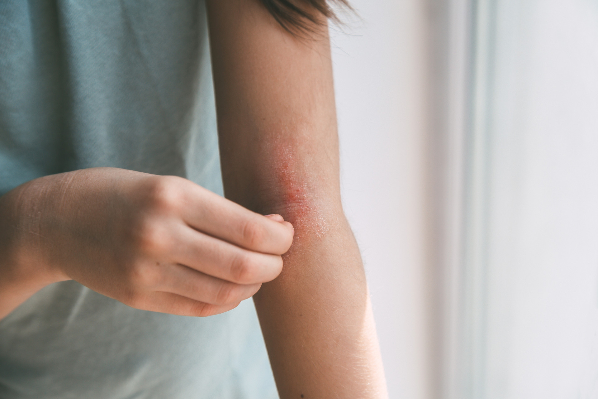 Sensitive skin: causes, care, and when to seek help