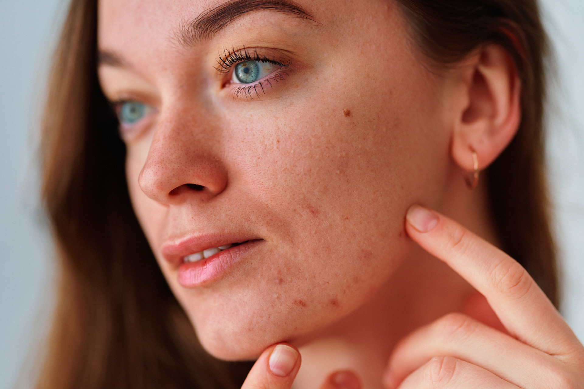 Sensitive skin: causes, care, and when to seek help