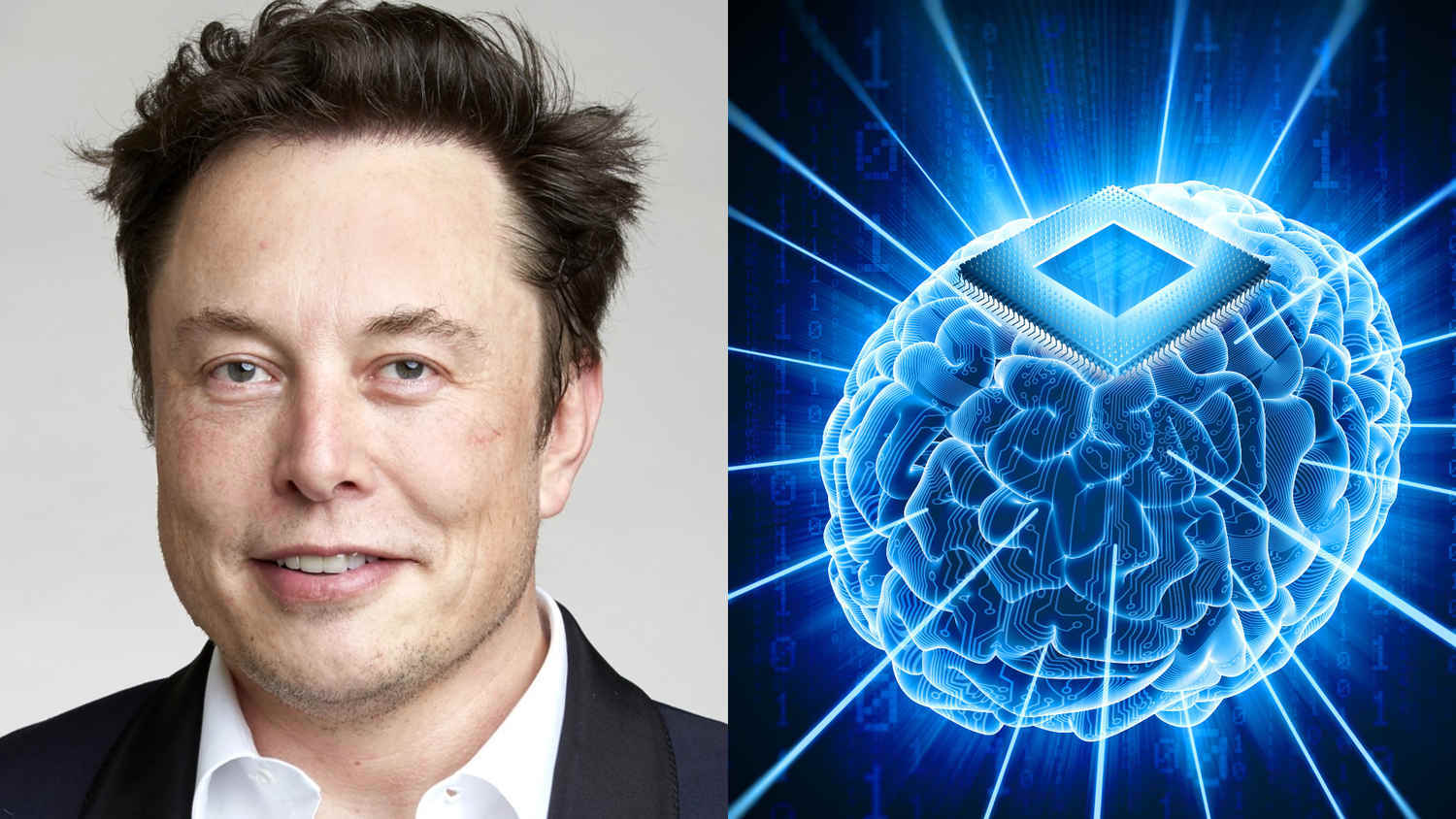 Elon Musk’s Neuralink has successfully implanted brain chip in third ... Elon Musk’s Neuralink has successfully implanted brain chip in third ...