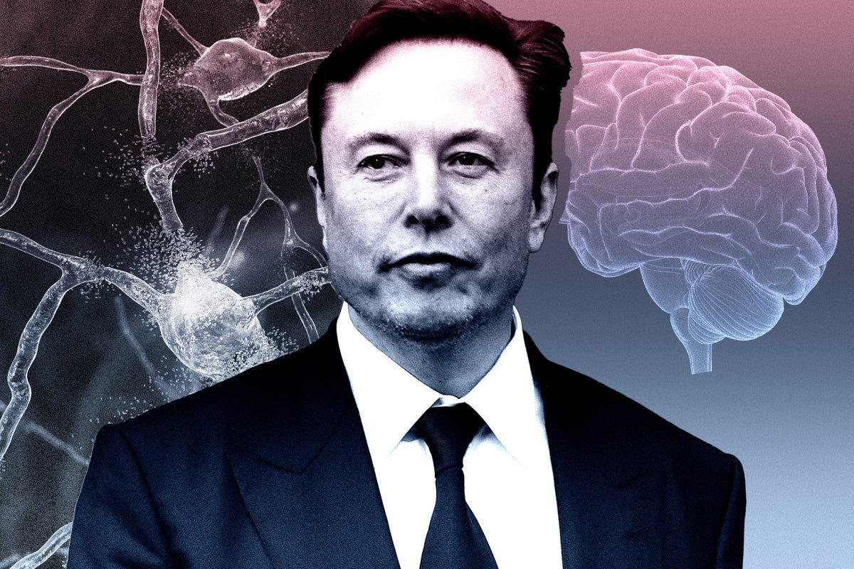 Elon Musk wants to implant millions of people with Neuralink brain chips Elon Musk wants to implant millions of people with Neuralink brain chips