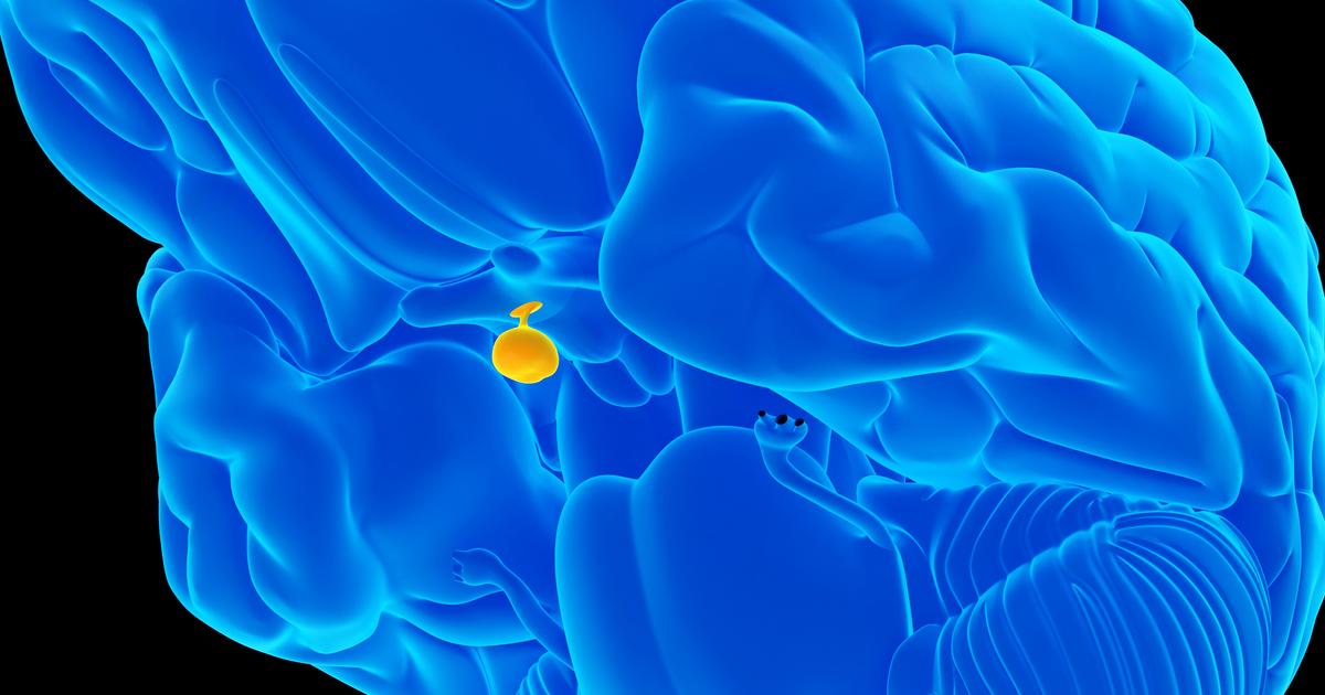 5 Mind-Bending Facts about Pituitary Tumors You Never Knew You Needed