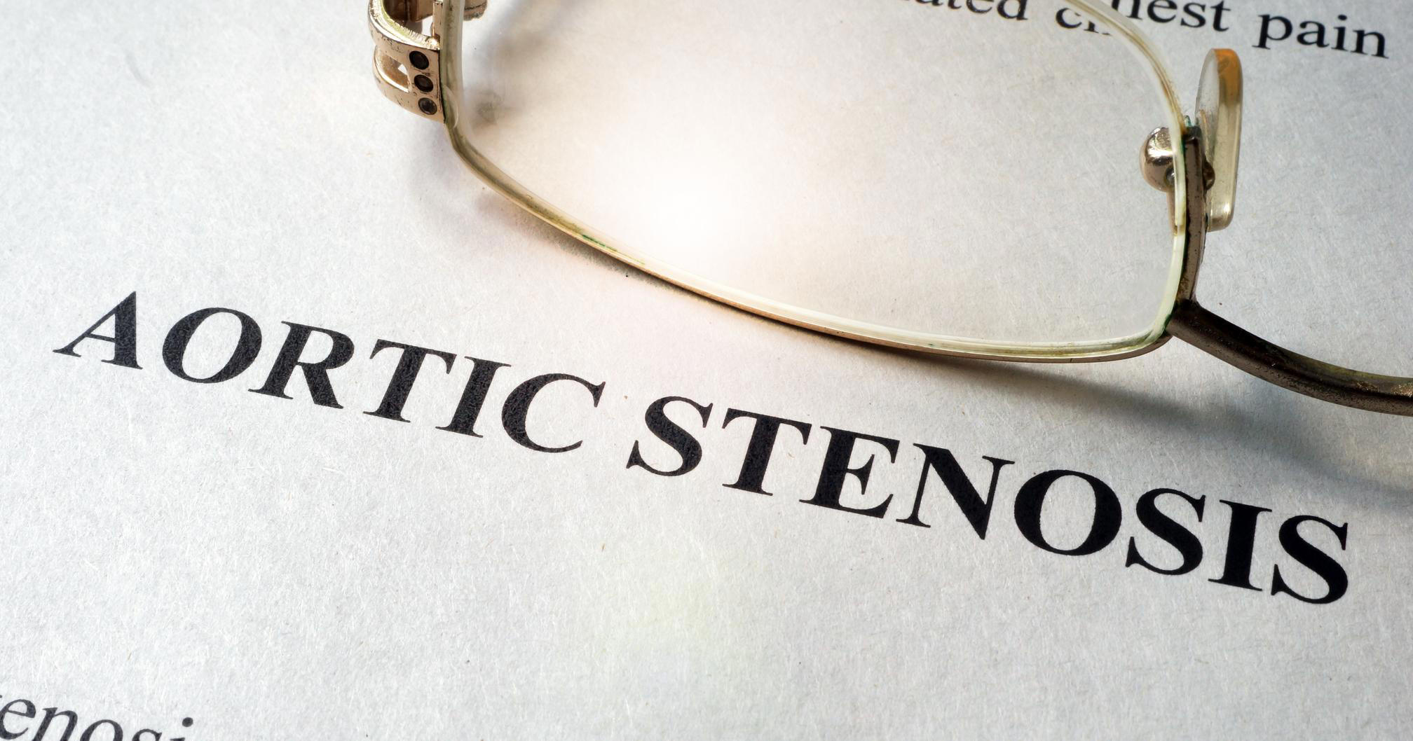 10 Unraveling Mysteries: Navigating the Labyrinth of Aortic Stenosis ... 10 Unraveling Mysteries: Navigating the Labyrinth of Aortic Stenosis ...