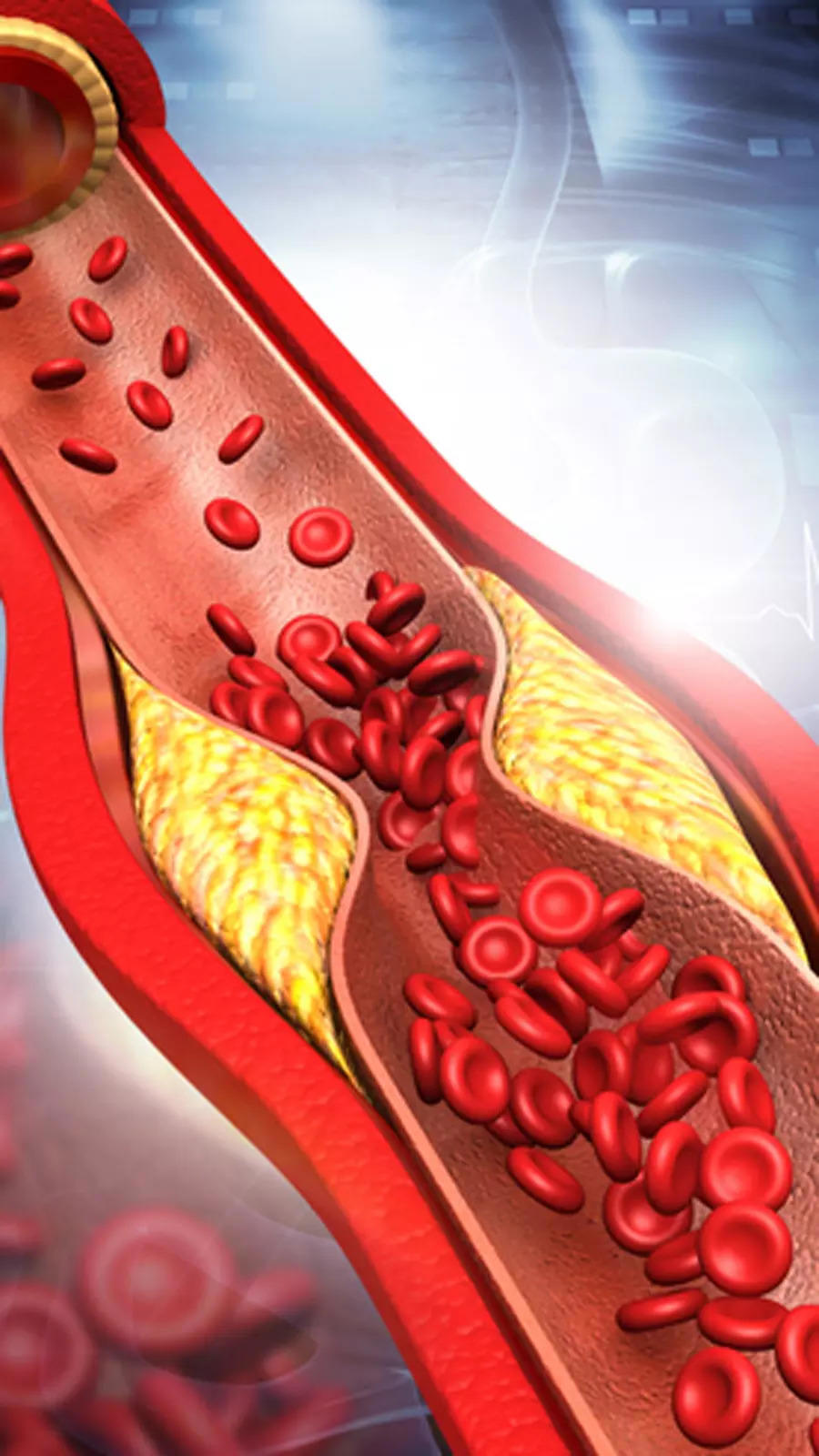 8 effective ways to lower high cholesterol levels naturally 8 effective ways to lower high cholesterol levels naturally
