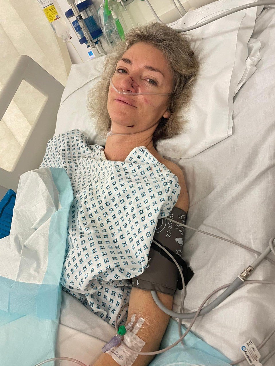 Full details of what happened to mother suing TfL for £25m after ...