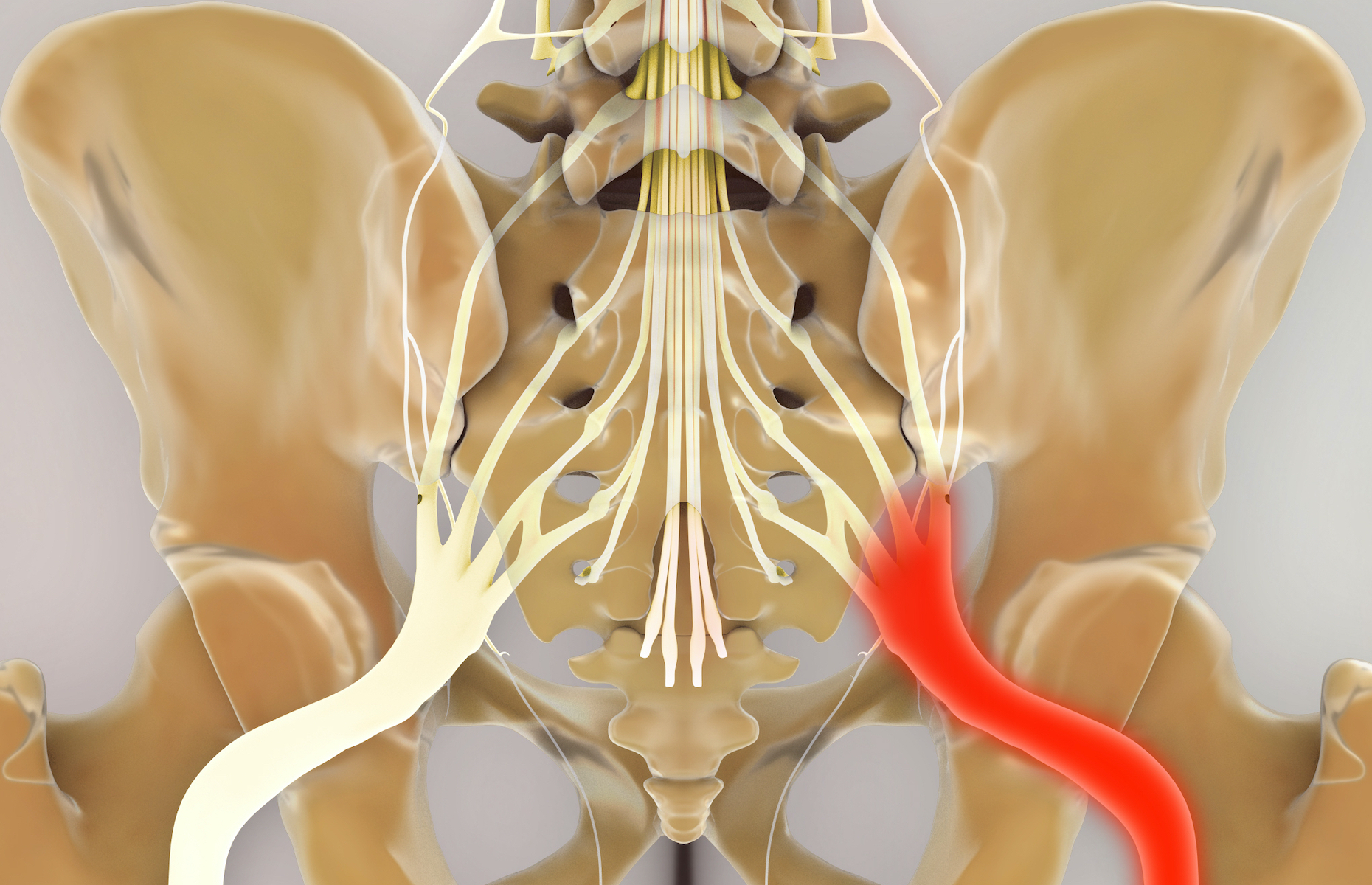 How to ease the symptoms of sciatica