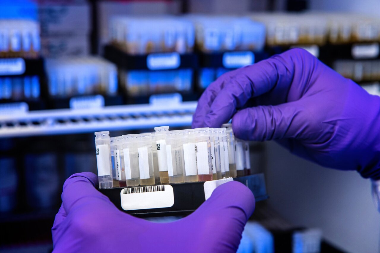 HER3-targeted antibody-drug conjugate shows promise for treatment ...