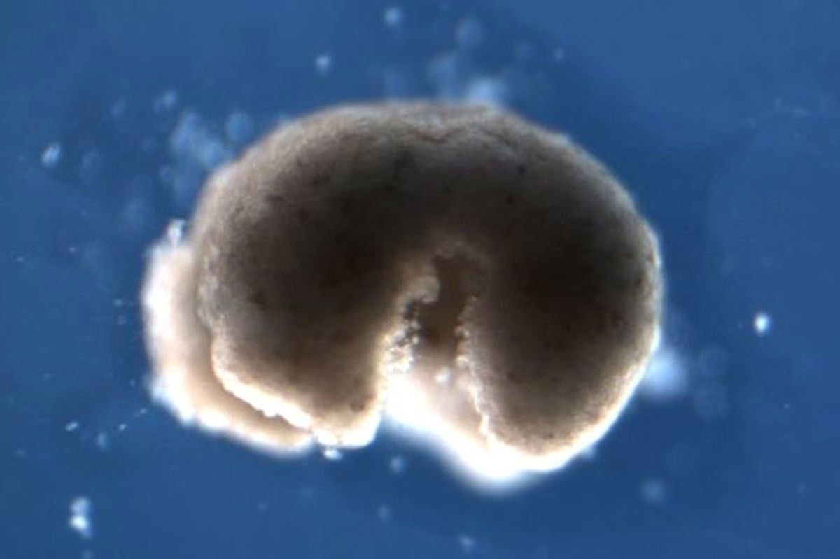 Scientists confirm existence of 'third state' which lies beyond life ... Scientists confirm existence of 'third state' which lies beyond life ...