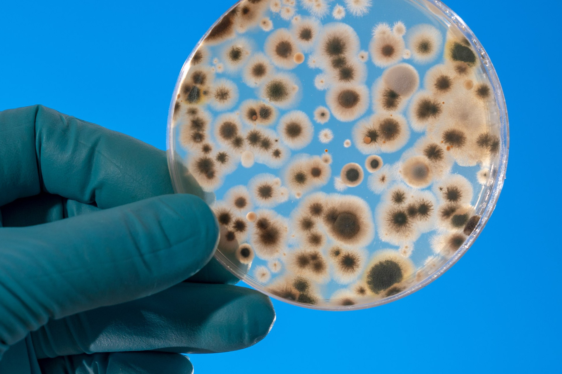 The rise of the superbug crisis that could kill millions