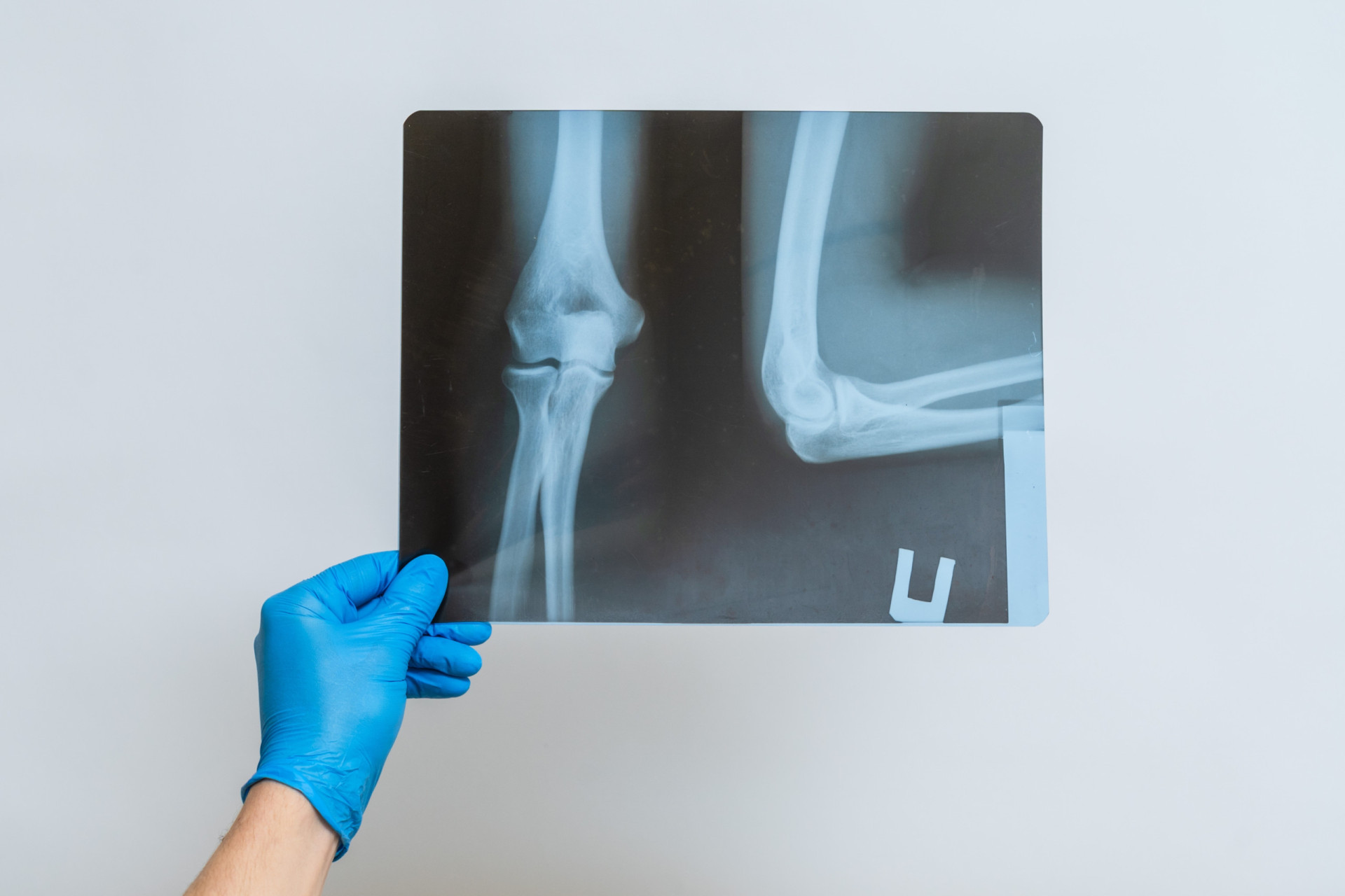 Vier personen om het leven gekomen door 'droog verdrinking'. Wat is dit ...