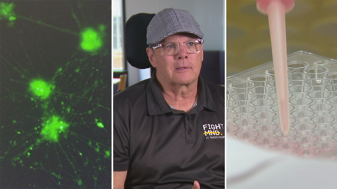 Researchers have 'absolute breakthrough' in search for MND cure Researchers have 'absolute breakthrough' in search for MND cure