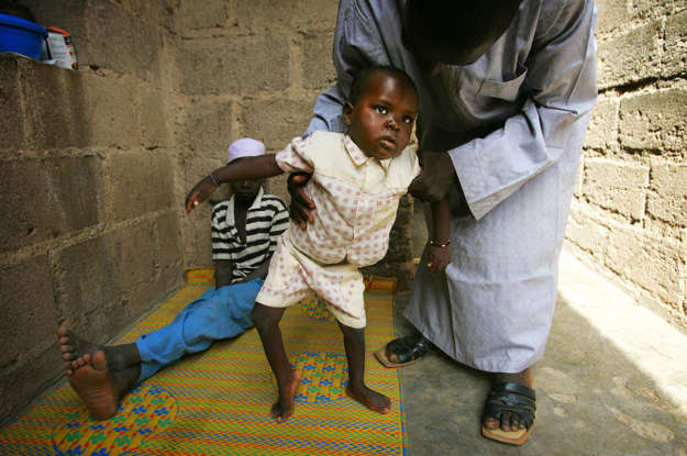 The history of polio: from eradication to reemergence The history of polio: from eradication to reemergence