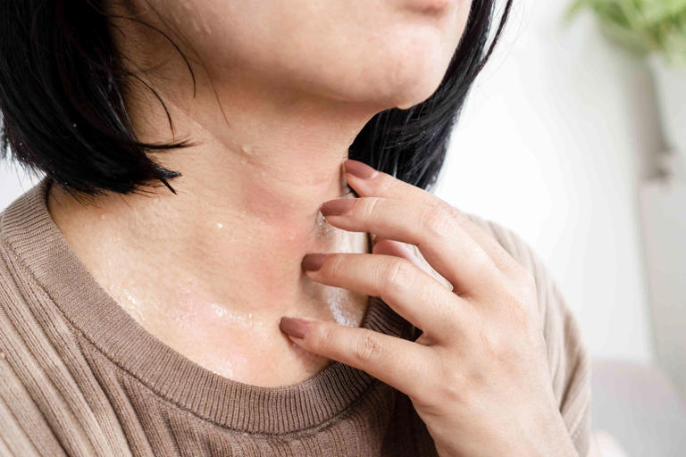 Why Do I Have a Rash on My Neck? Causes, Symptoms, and More
