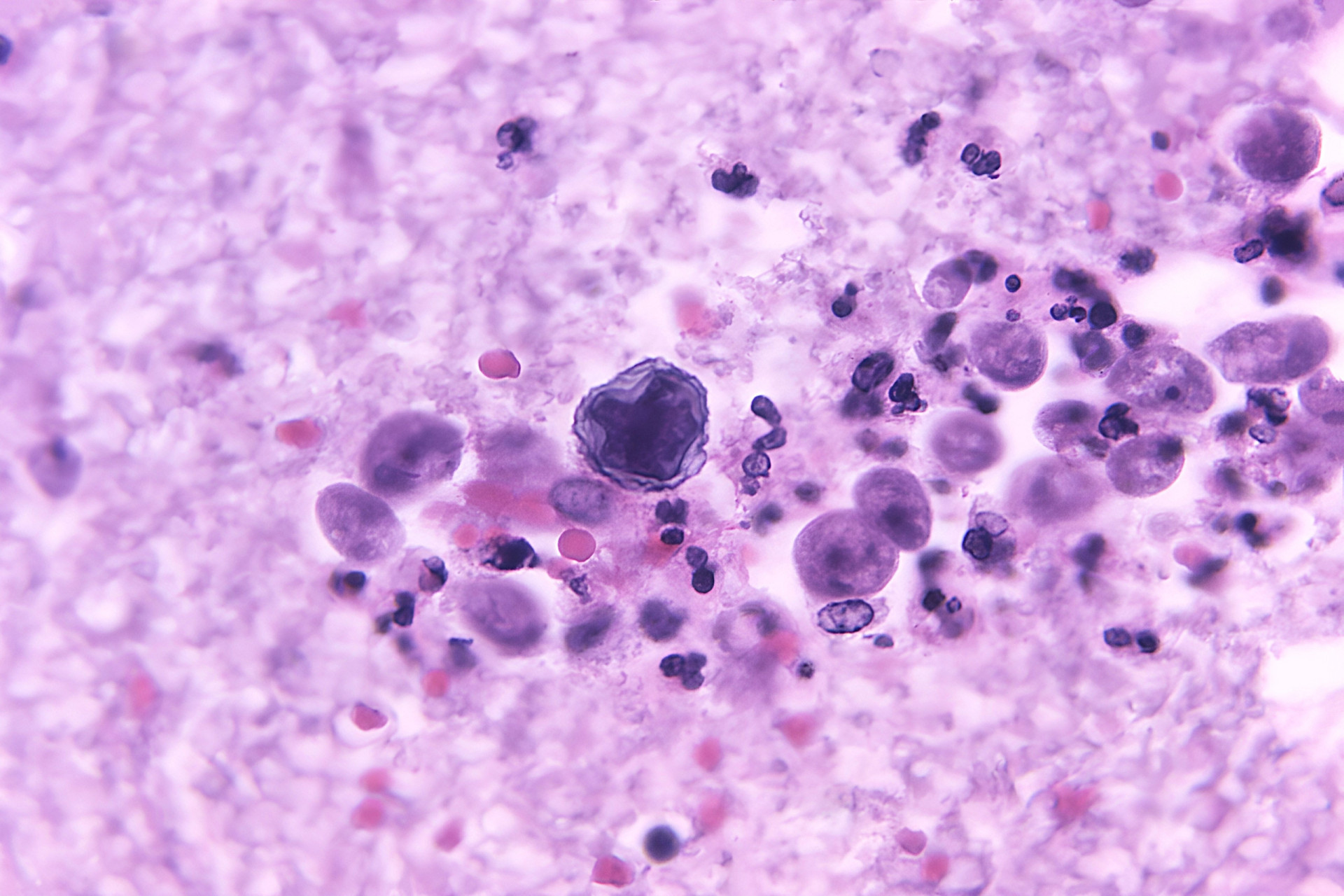 Les infections par des amibes : ce que vous devez savoir