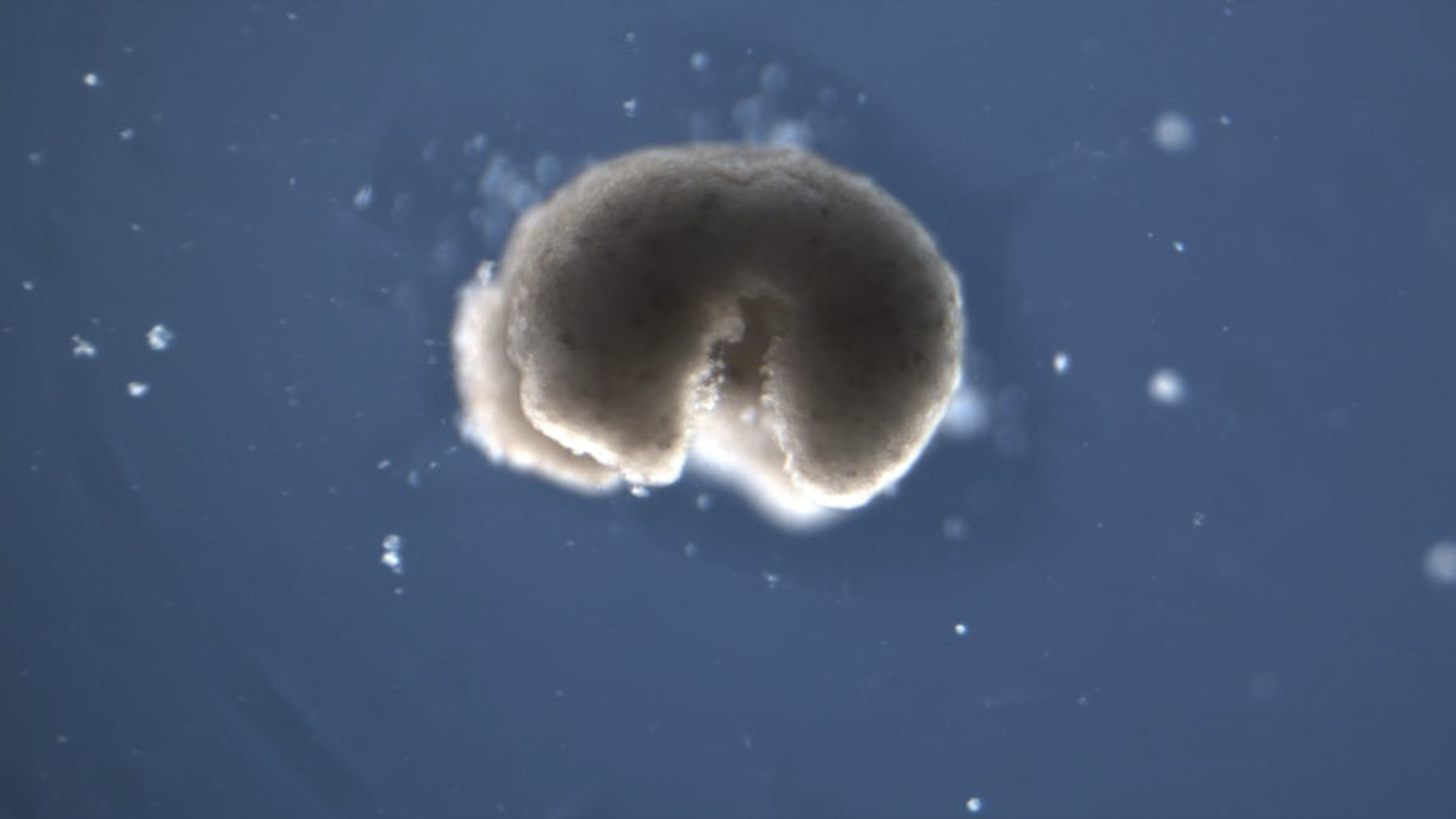 Some cells can enter a 'third state that lies beyond the traditional ... Some cells can enter a 'third state that lies beyond the traditional ...