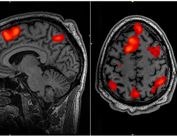 A New Understanding of How the Brain Adapts to Changing Situations A New Understanding of How the Brain Adapts to Changing Situations