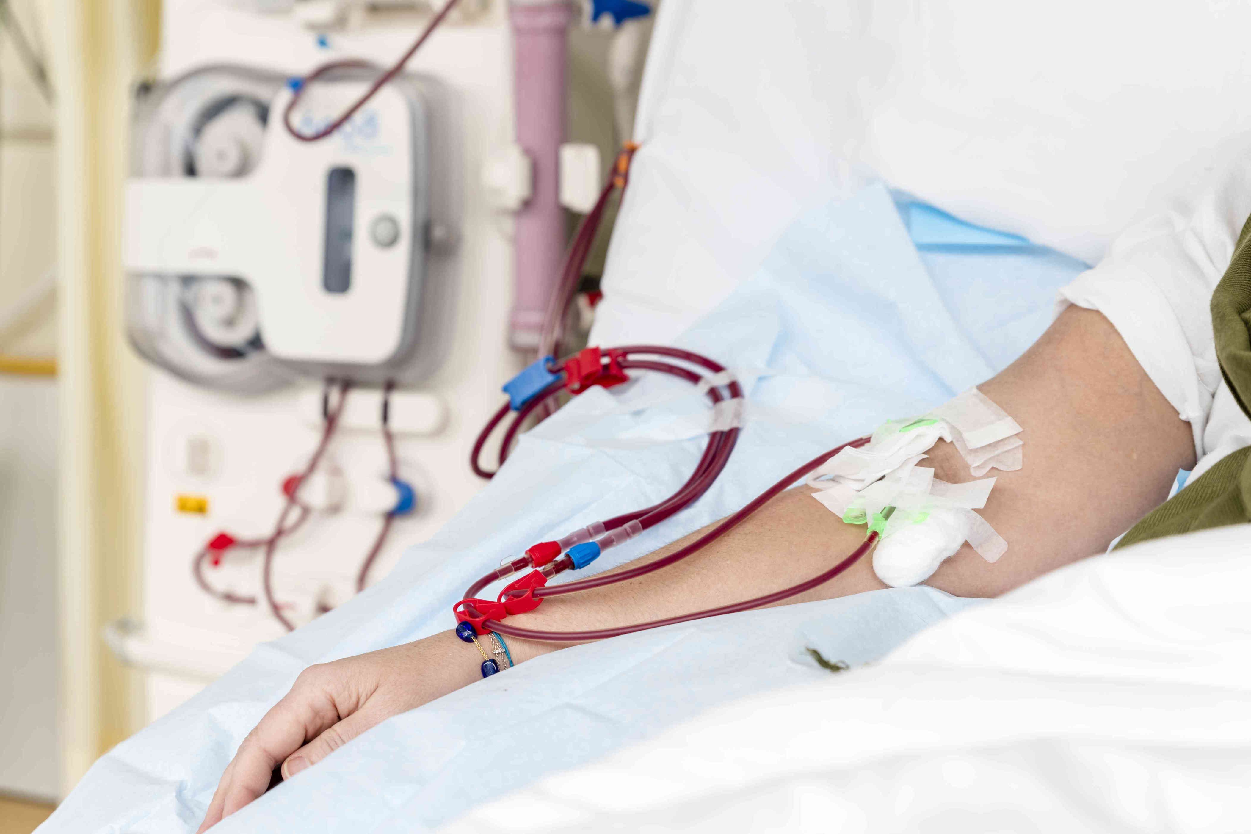 How Is Kidney Failure Treated?