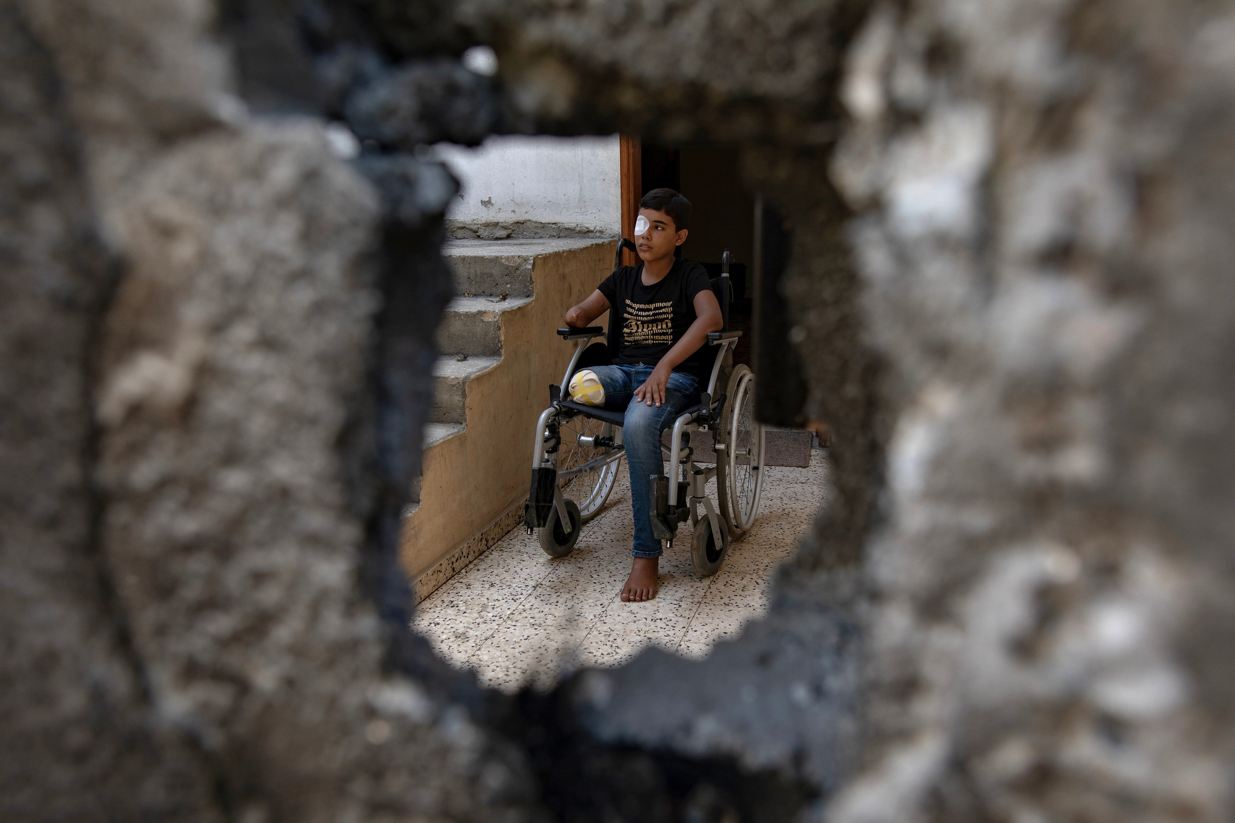 About 2,500 children need urgent evacuation from Gaza for medical ...