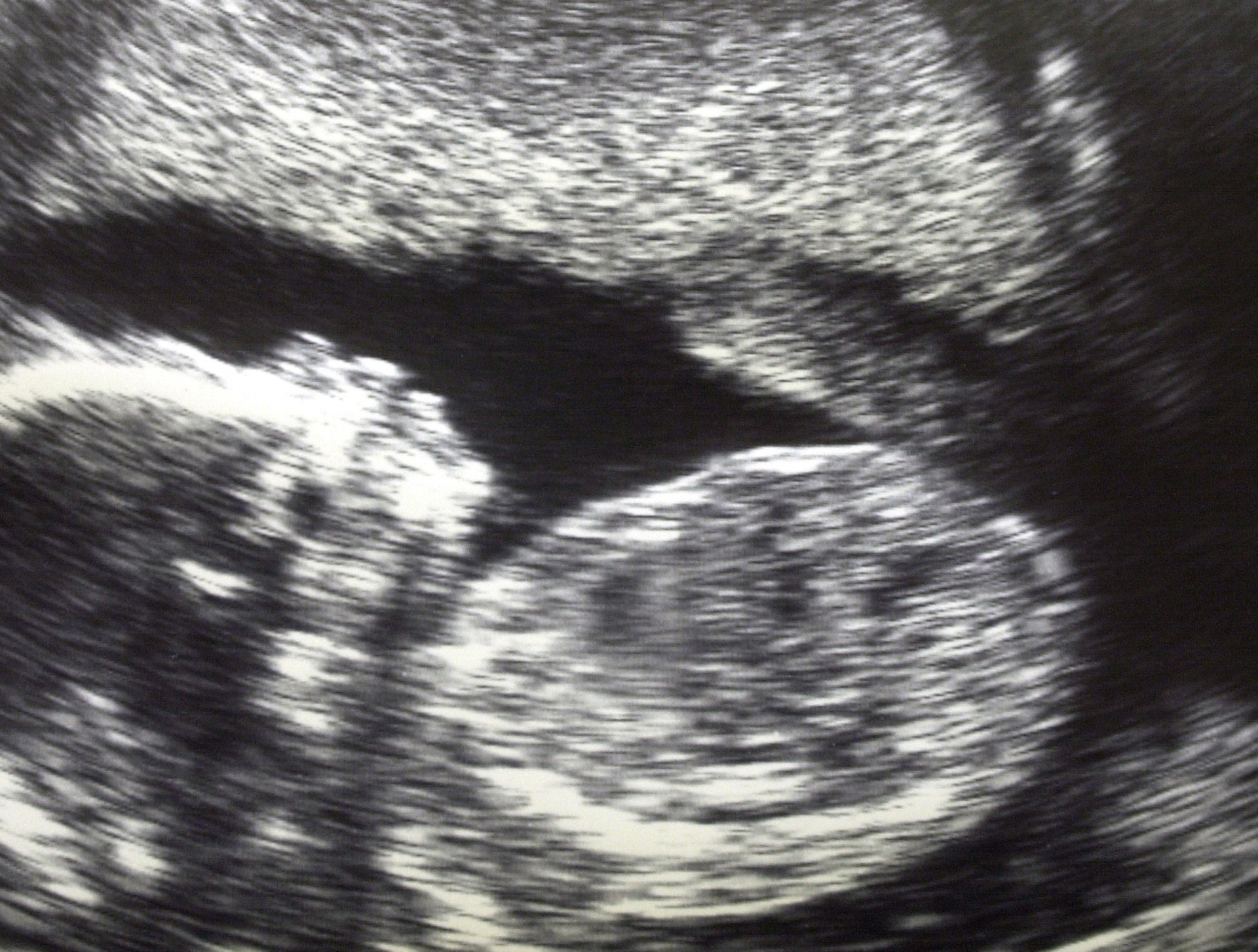 30 amazing facts about fingerprints