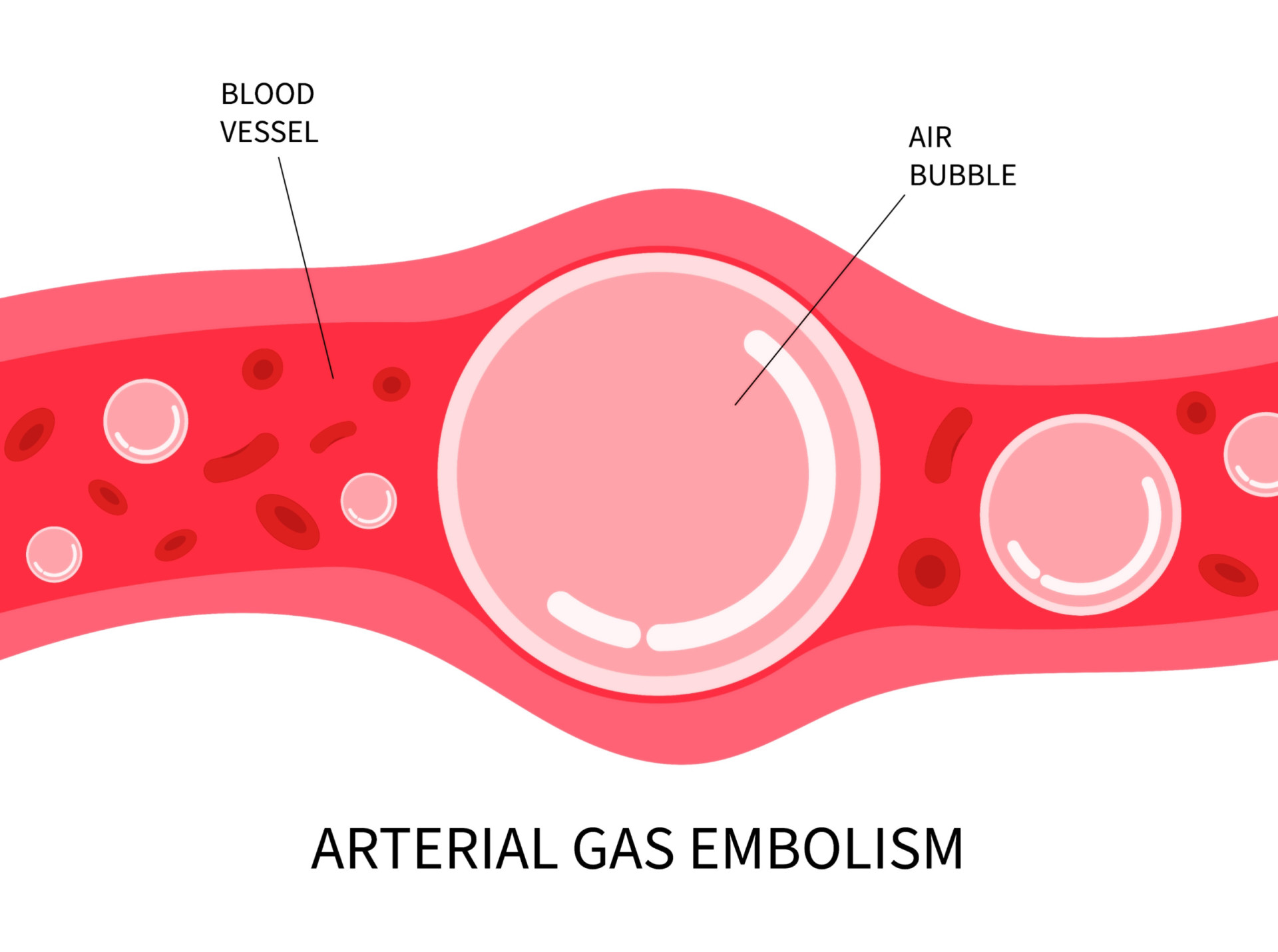 Les dangers invisibles de la plongée : tout savoir sur la maladie de ...