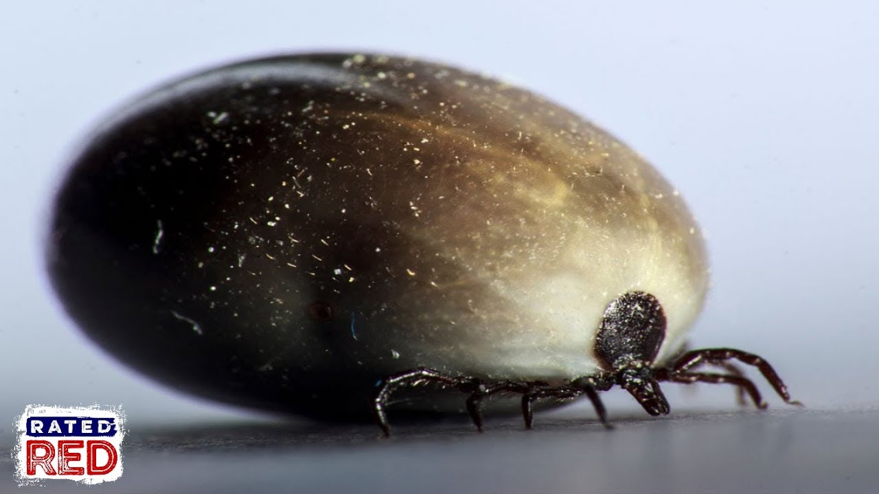 Got A Tick? Here's The Right Way to Safely Remove a Tick