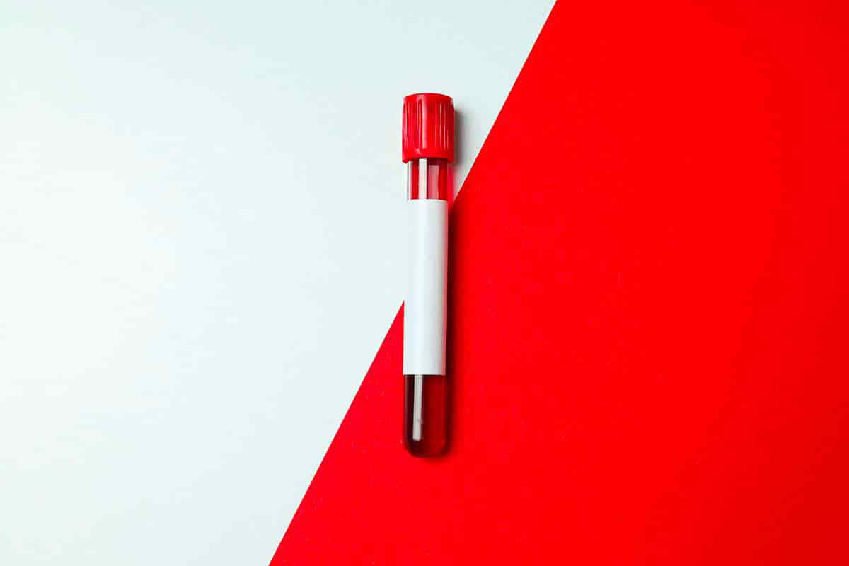Rare blood type mystery solved : Scientists uncover new blood group ... Rare blood type mystery solved : Scientists uncover new blood group ...